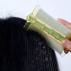 Best Top 10 Chemical-Free Head Lice Removal - Smart Gadgets Idea
